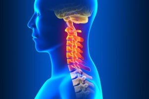Understanding Cervical Spinal Stenosis