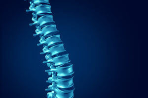 3 Ways to Treat Spinal Cysts
