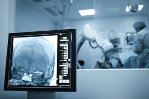 What Is a Cerebrospinal Fluid Culture?